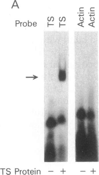 Specific Binding Of Ts Protein To Ts Mrna A Labeled Human Ts Rna 1