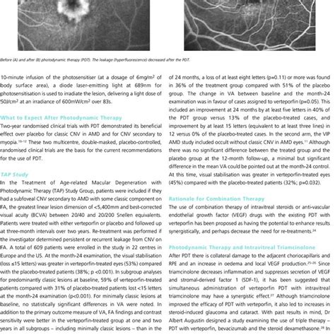 Subfoveal Choroidal Neovascularisation Due To Age Related Macular Download Scientific Diagram