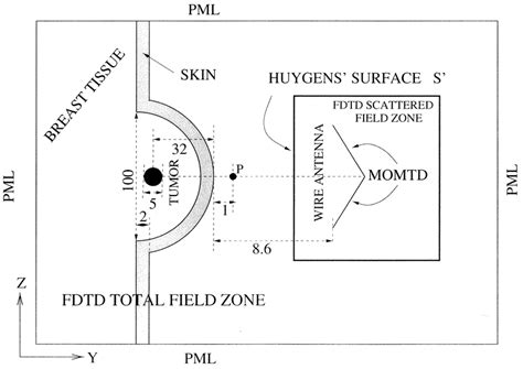 Computational Model Of A Breast Tumor Detection System All Dimensions Download Scientific