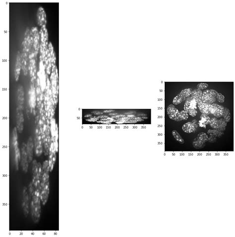 D Image Segmentation Bio Image Analysis Notebooks