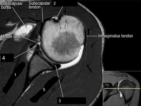 Diagram Of Week 3 Mri Axialtransverse Plane Quizlet