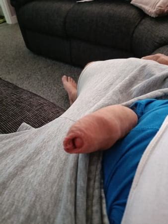 Soft Dick And Foreskin Pics Xhamster