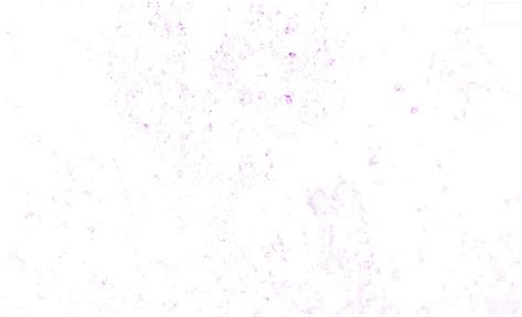 Creating Multiple Stain Vectors In Qupath With A Brightfield H Dab