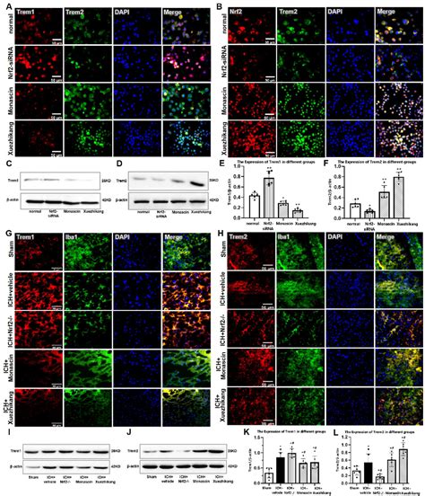 Figure 1 From Neuroprotection By Nrf2 Via Modulating Microglial