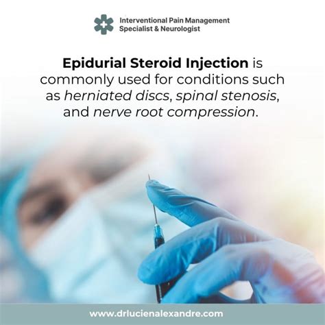 Epidural Steroid Injections Dr Lucien Alexandre Md Phd