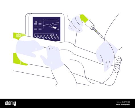 Vascular Surgery Abstract Concept Vector Illustration Stock Vector