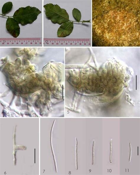 Pseudocercospora Puderi On Rosa Sp From Leaf Spots 1 2 Leaf Spots Download Scientific