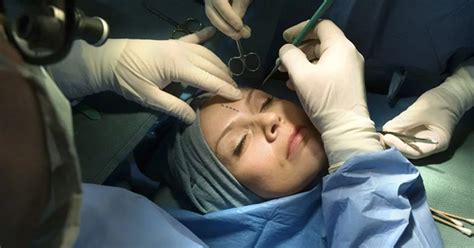 Plastic Surgeon Reveals The Weirdest Things He Has Seen And Strangest