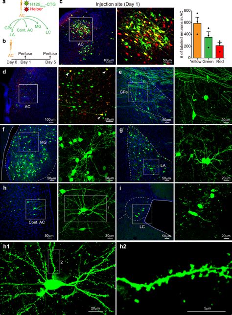 Fast Bright Tracing The Auditory Cortex Projection Pathways With