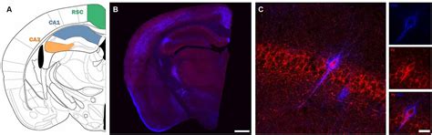Frontiers Parvalbumin Interneurons And Perineuronal Nets In The Hippocampus And Retrosplenial