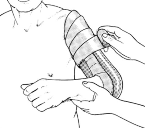 Coaptation Splint