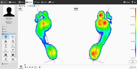Gait Analysis Nottingham Sports Injury Clinic Advanced