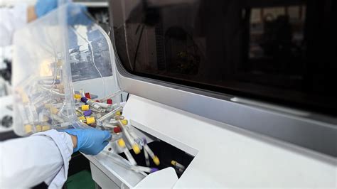 If Design Automated Blood Sample Processing System