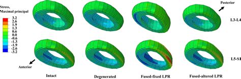 Contour Plots Of Maximal Principal Stresses Mpa In The Disc Annulus