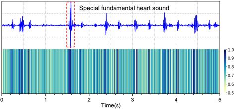 Heart Sound Signals And Corresponding Attention Maps Learned By The Cta