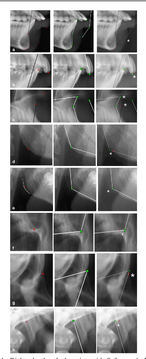 Figure 14 From Human Examination And Artificial Intelligence In Cephalometric Landmark Detection
