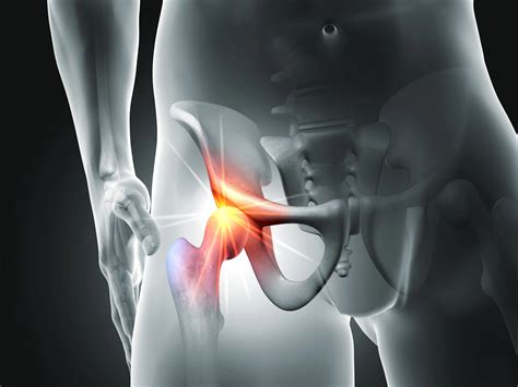 Hip Joint Diagram