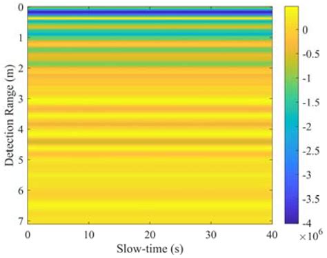 Multiple Stationary Human Targets Detection In Through Wall Uwb Radar