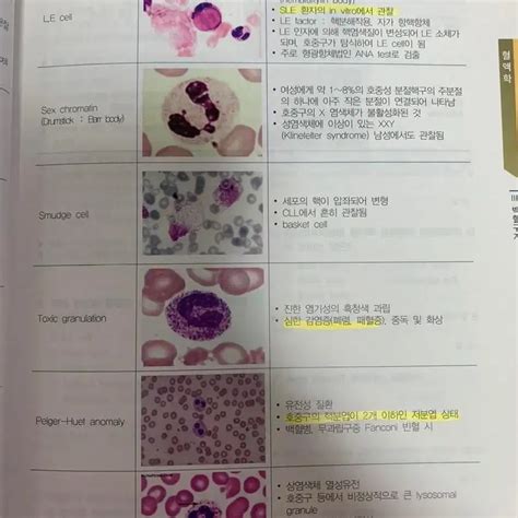 Learningdictionaryreference Book 임상병리사국가고시임상병리문제집임상병리학과 On Bunjang