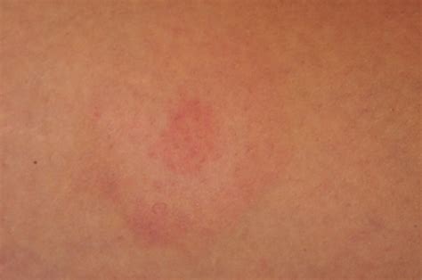 Better In Emergency Medicine An Introduction To Medical Photography