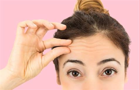 How To Make Your Forehead Smaller Naturally Ways