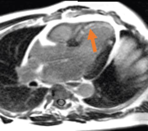 Low Versus Ultra High Field Mri How To Select Your Mri Fleet Applied Radiology