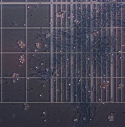 What Is This Structure Im Seeing On My Trypan Blue Stain R Labrats