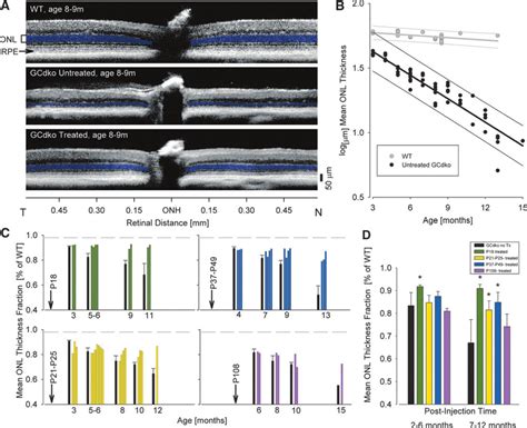 Oct Abnormalities In Gcdko Retinas And The Effect Of Treatment A
