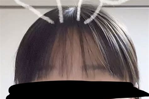 앞머리 숱 늘리기 지식in