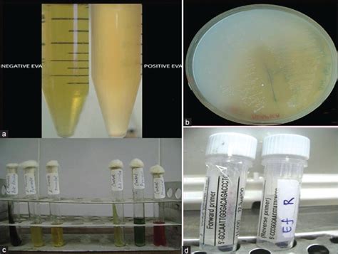 Molecular Identification Of An Enterococcus Faecalis Endocarditis