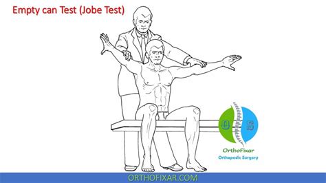 Empty Can Test For Supraspinatus Impingement Orthofixar 2025