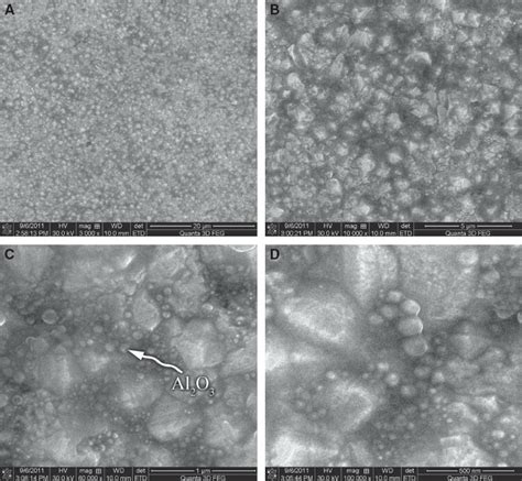 Microstructure Of Ni Nano Al2o3 Composite Coatings Of Optimized