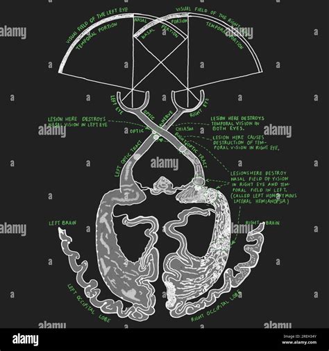 Visual Pathway Scheme Vintage For Education Or Science Detailed Eye And Brain Typography With