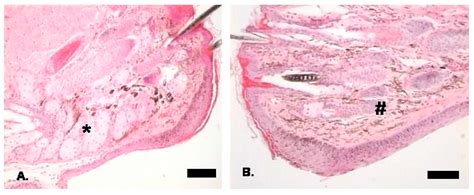 Extended Overview Of Ocular Phenotype With Recent Advances In