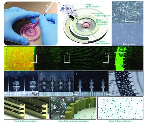 Overview Of The Sperm Selection Process Within The Microfluidic Device Download Scientific