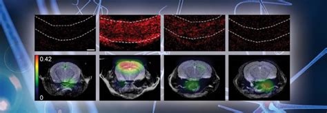 Preclinical Hyperpolarized Carbon 13 Magnetic Resonance Imaging In Neurological Disease Models