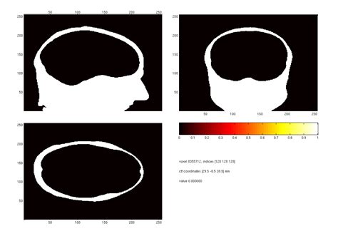 How Is A Segmentation Defined Fieldtrip Toolbox