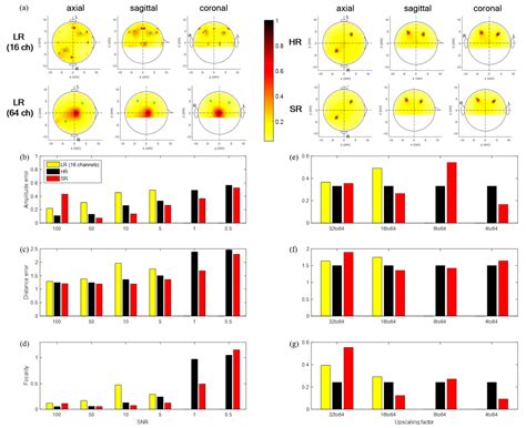 Super Resolution For Improving Eeg Spatial Resolution Using Deep Convolutional Neural Network