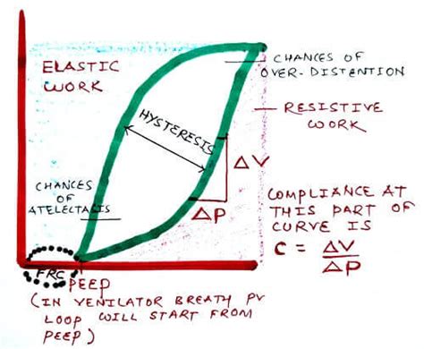 Ventilator Graphics Made Easy Dnb Pediatrics