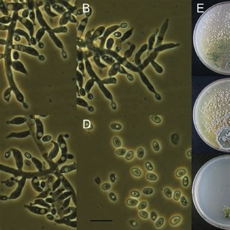 Macroscopic And Microscopic Features Of Trichoderma Spirale Kuc21268