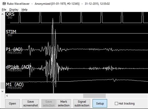 DICOM Waveform Viewer Display