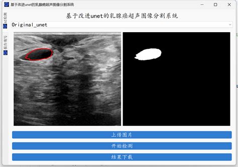 【大作业 59】基于改进unet的乳腺癌超声图像分割系统 Csdn博客