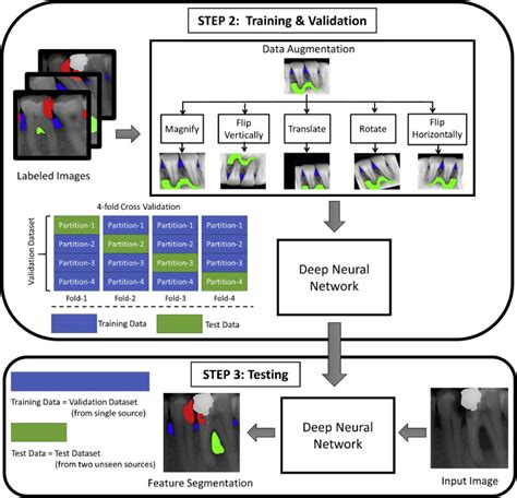 Automated Feature Detection In Dental Periapical Radiographs By Using Deep Learning Oral