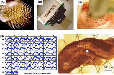Metal Microwire Electrodes A Photograph Of 128‐microwire Array