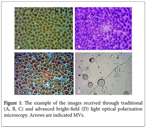 The Advanced Bright Field Light Optical Polarization Microscopy