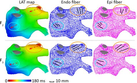 When We Take A Closer Look We Find That Fibers Do Affect Local Activation Patterns If
