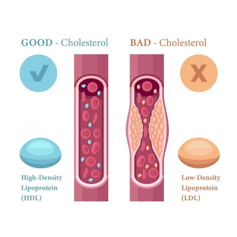 Das Cholesterin Dilemma