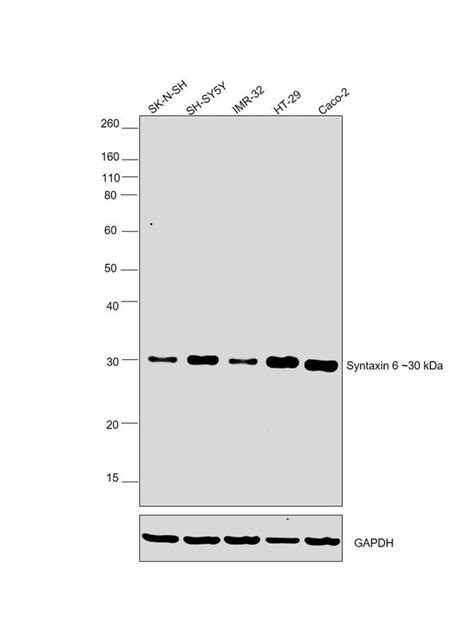 Anti Syntaxin 6 Antibody Rp23040114 Golgi Membrane Marker Ab313440 Abcam