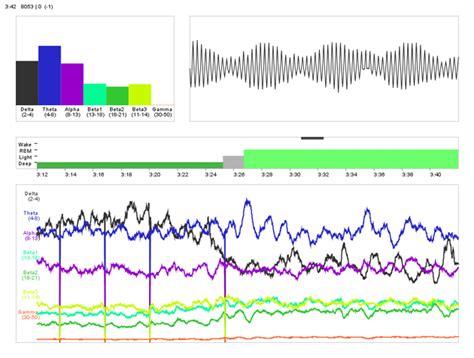 GitHub Evsc ZeoLibrary Processing Lib To Import Stream And Analyse Your Zeo Sleep Data