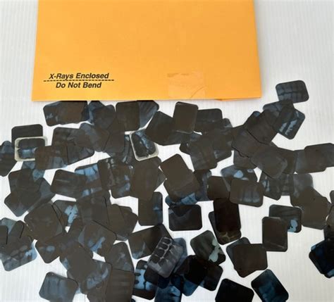 100 Vtg Dental X Rays Dentist Teeth Tooth Xray Lot Fillings Cavaties